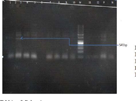 Figure 3 From Molecular Detection Of Babesia Bovis And Babesia Bigemina
