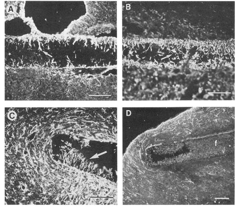 Neuron Projection Extension Involved In Neuron Projection Guidance