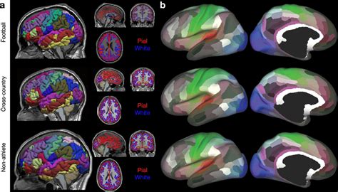 Anatomical T1w Preprocessing Freesurfer And 180 Node Multimodal Download Scientific Diagram
