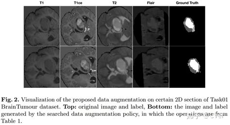 Asng：用于3d医学图像分割的自动数据增广 知乎