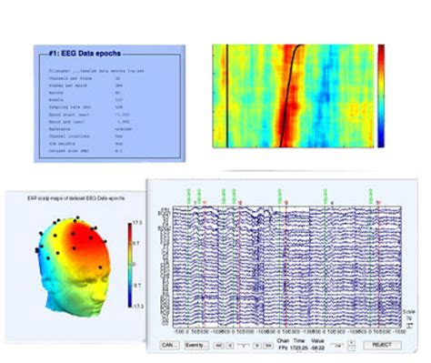 eeg analysis overview