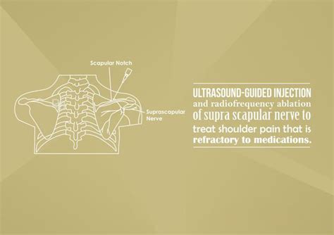 Compressed Suprascapular Nerve Relief Atlas Pain Care