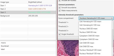Script The Creation Of A Classifier In Qupath — Image Scientist
