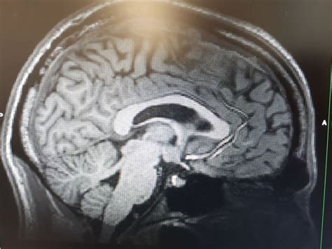 Neuroscience Lifepath Analytics Journey Guy Kerem