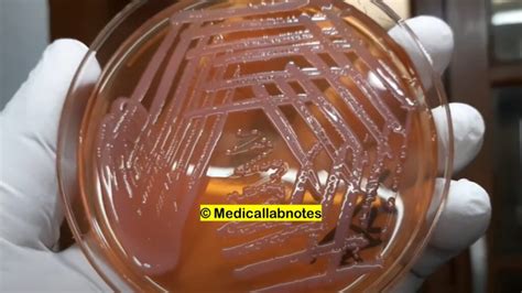 Acinetobacter Introduction Morphology Pathogenicity Lab