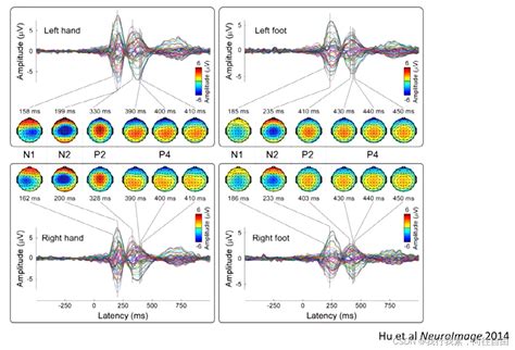 脑电信号处理与特征提取——4脑电信号的预处理及数据分析要点（彭微微） Csdn博客