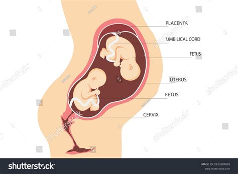 Double Pregnancy Anatomy Uterus Twin Fetuses Stock Vector Royalty Free