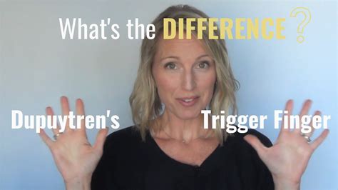Trigger Finger Versus Dupuytrens Contracture Whats The Difference