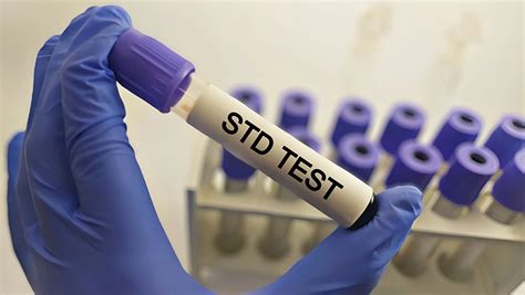 Can Urgent Care Centers Do Std Testing Aether Health