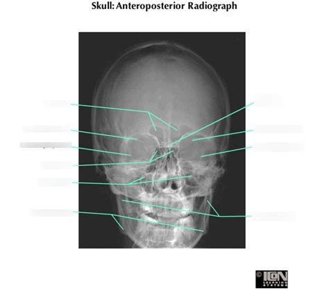 Skull Ap Radiograph Diagram Quizlet