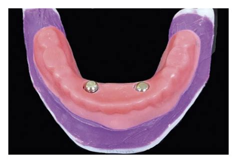 Methodology Of 2imo Simulation Using 3d Printed Models A Download Scientific Diagram