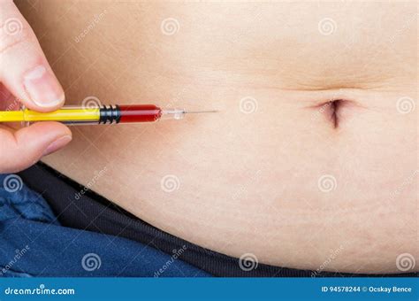 Abdominal Insulin Injection Royalty Free Stock Image 87815542