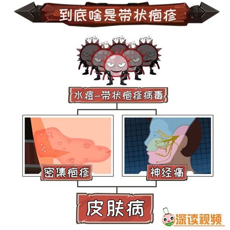 什么是带状疱疹？多久可以痊愈？ 知乎