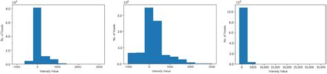 Dual Stage Deeply Supervised Attention Based Convolutional Neural Networks For Mandibular Canal