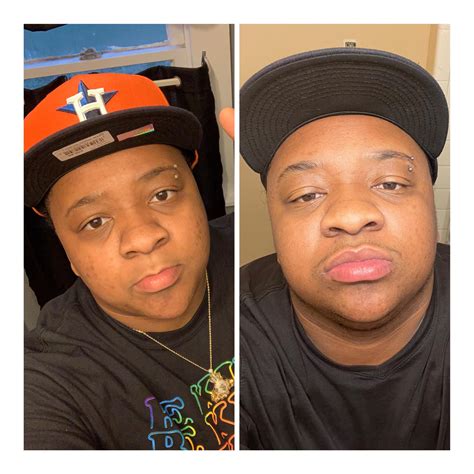 Pre T Vs 8 Months Only Really Notice The Facial Hair Body Hair