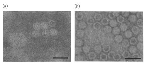 Electron Micrograph Of Recombinant Vlps A And Csci Gradientpurified