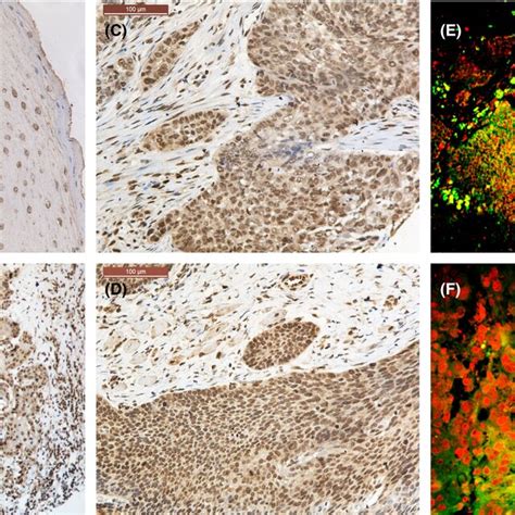 Immunohistochemistry Results For Tgf‐β1 And Double Immunofluorescence Download Scientific