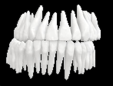 Crossbite Orthero Clear Aligners