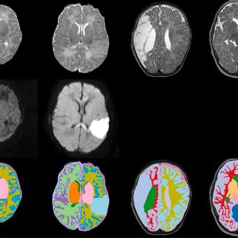 Examples Of Reference Segmentations That Are Used During Training And Download Scientific