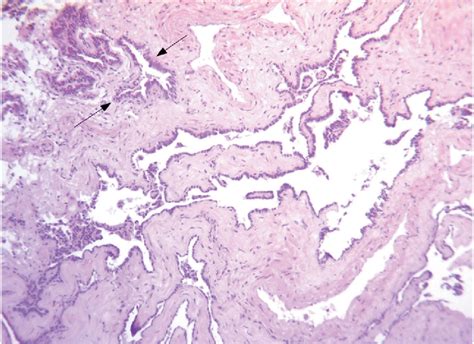 Rete Testis Histology