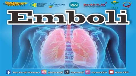 Emboli Rsup Dr Soeradji Tirtonegoro