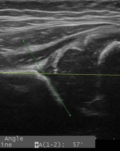 Pediatrics 97 Infant Hip And Knee Case 972 Infant Hip
