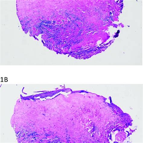 Tma Cores Sectioned Before A And After B Rna Isolation Showing Download Scientific Diagram
