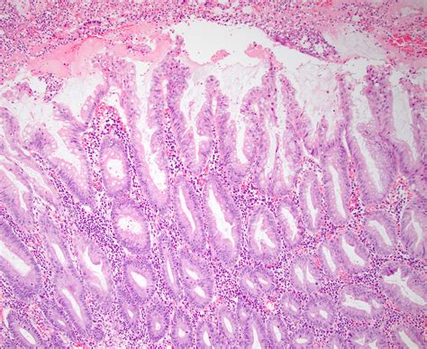 Pathology Outlines Question Bank
