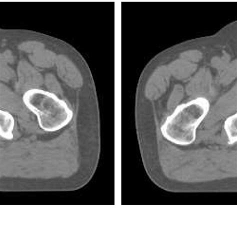 A Discrete Truth Image And B Asd Pocs Reconstruction Download Scientific Diagram