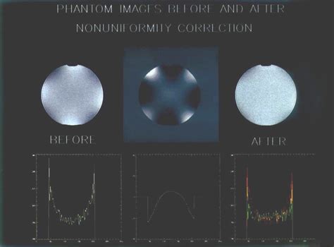 Nonuniformity Correction Applied To A Phantom The Upper Panel Consists Download Scientific