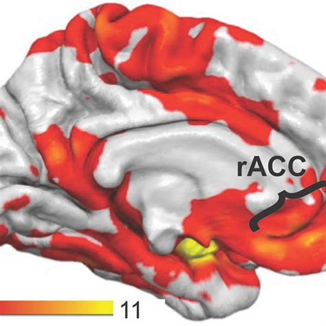 Resting Functional Connectivity The Voxelwise Resting State Functional
