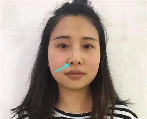 鼻孔外露是不是有点土气，应该如何改善 知乎