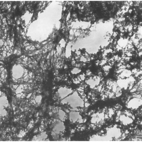 Nuclear Matrix Made By Applying 2 M Naci Directly Direct Application