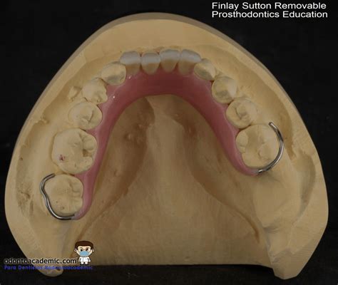 Elaboración De Prótesis Dental Superior Paso A Paso Odontoacademic