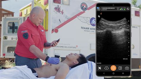 Fast Exam For Ems Clarius