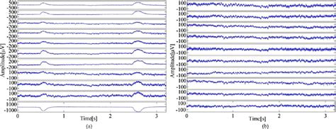 Figure 1 From The Removal Of Eog Artifacts From Eeg Signals Using Independent Component Analysis