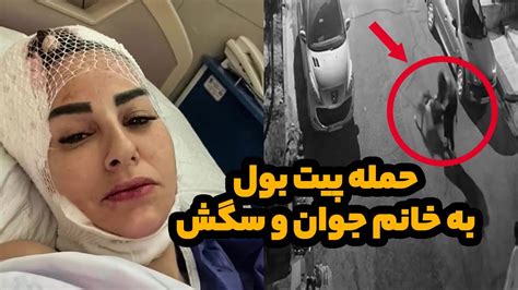 حمله سگ پیت بول به خانم جوان در شهرک غرب⛔ Youtube