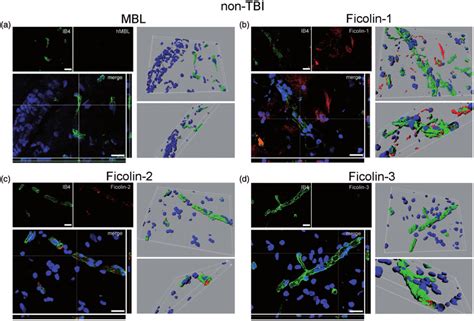 Lectin Pathway Initiators Present Different Patterns In Non TBI Human Download Scientific