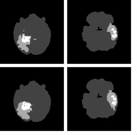 figure 1 from handling unbalanced data in deep image segmentation