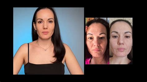 Избавляемся от ОТЕКОВ на ЛИЦЕ навсегда в ДВА ПРОСТЫХ ШАГА - YouTube