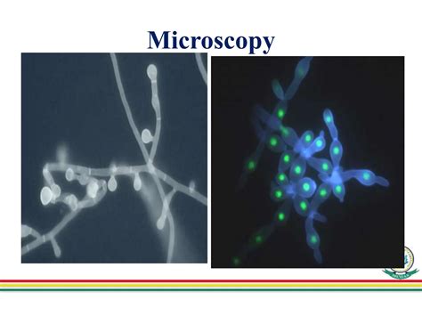 12 Fungal Identification Methods New Ppt