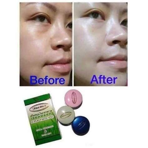 Face Extra Super Lifting Meyong Cream Set Made In Thailand Shopee Philippines