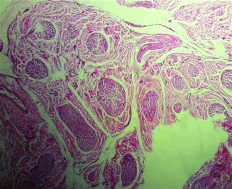 Normal Nerve Cross Section In The Control Group With No Damage To The Download Scientific