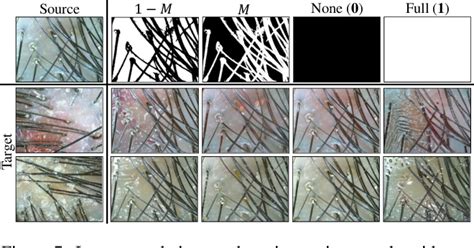 Figure 7 From Scalp Diagnostic System With Label Free Segmentation And Training Free Image