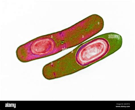 Clostridium Difficile Drug Resistant Bacteria Coloured Transmission
