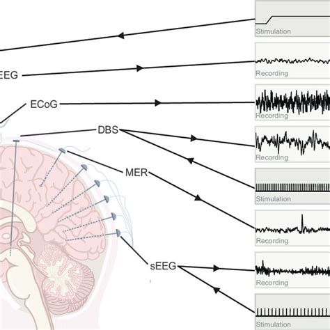 Major Electrical Recording And Stimulation Approaches For Brain Machine Download Scientific