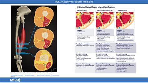 Smug Msk Ultrasound Courses On Linkedin T And V Junction Muscle