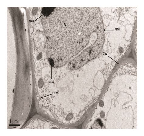 Electron Micrographs Of Root Cells Of 6 Day Old Seedlings Of Two Download Scientific Diagram