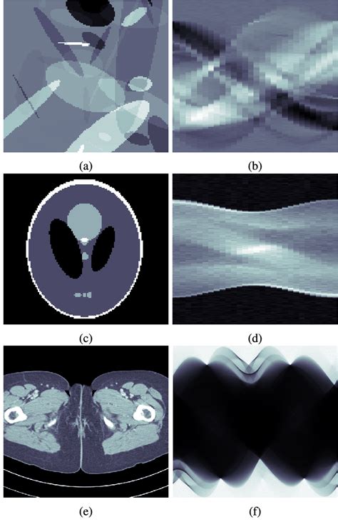 Figure 1 From Learned Primal Dual Reconstruction Semantic Scholar