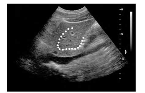 纹理分析以及结合深度学习来提升纹理分类效果 极术社区 连接开发者与智能计算生态